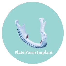 Implant Dentist Sunnyvale - Sunnyvale Dentist | Sunnyvale Dental Care
