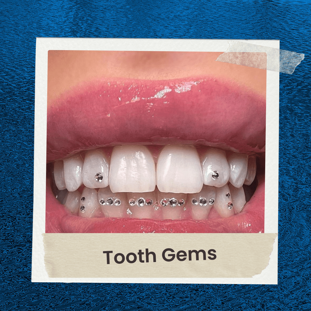 Tooth Gem Care 101: How to Keep Your Smile Sparkling and Safe